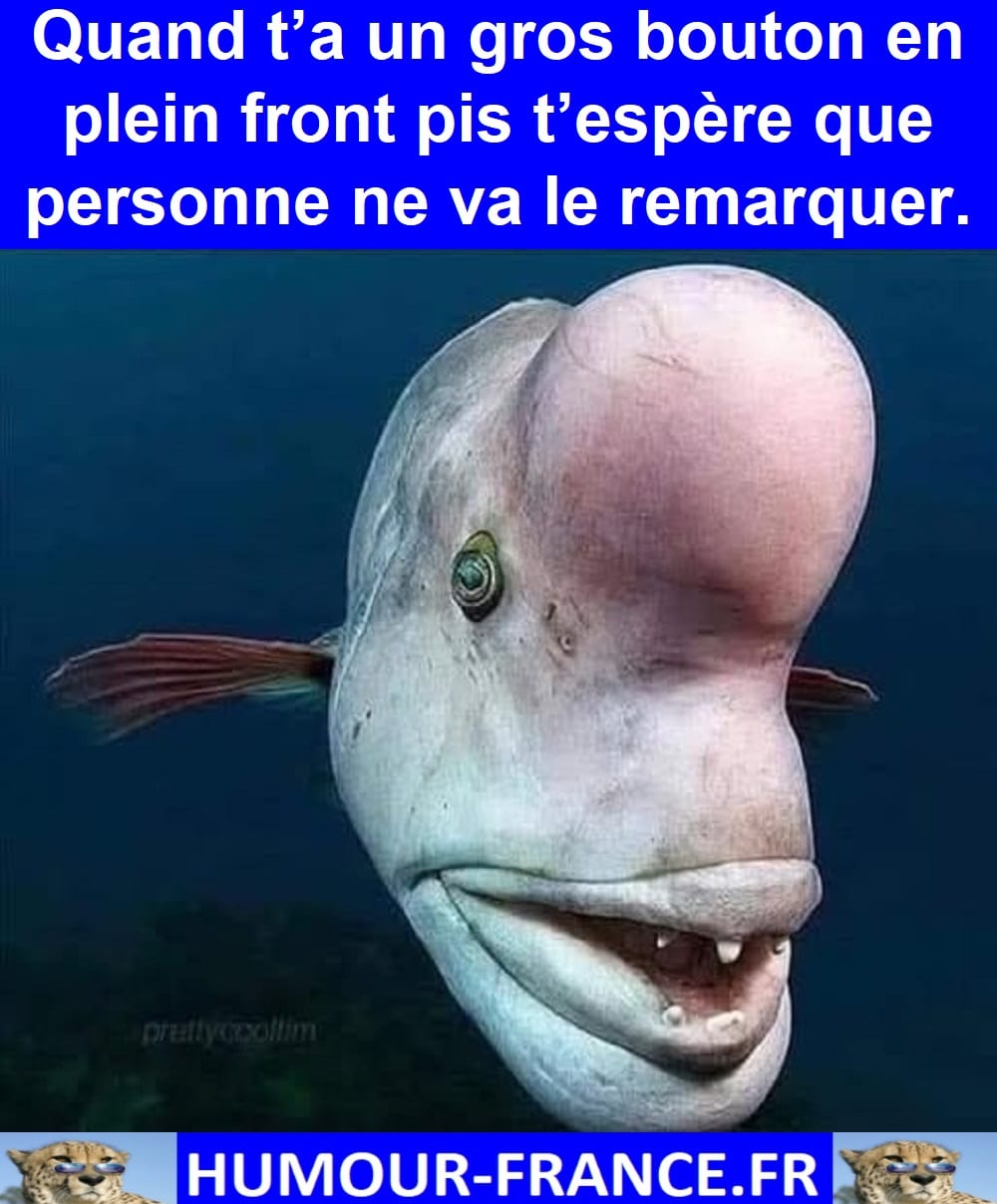 Quand t’a un gros bouton en plein front pis t’espère que personne